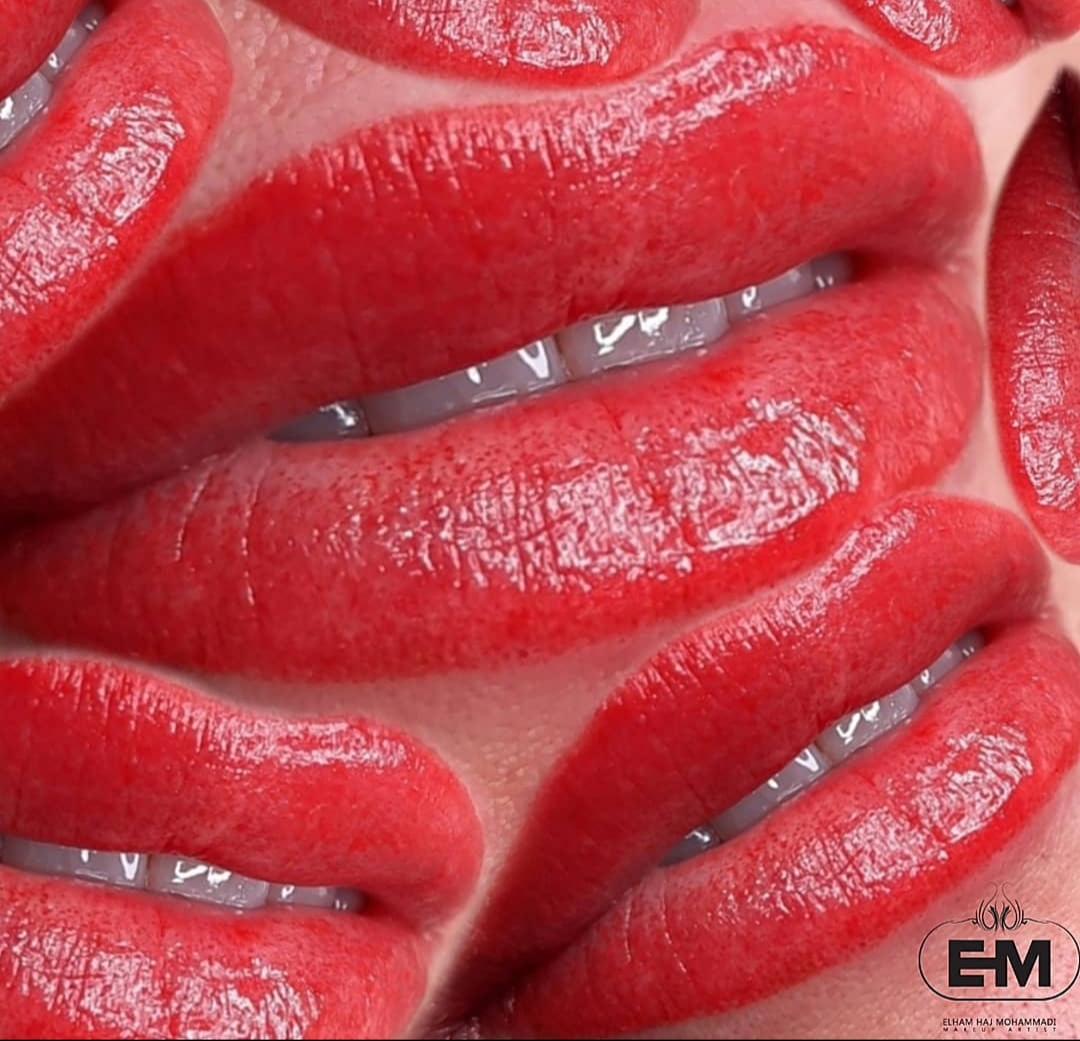 میکروبلیدینگ الهام حاجی محمدی